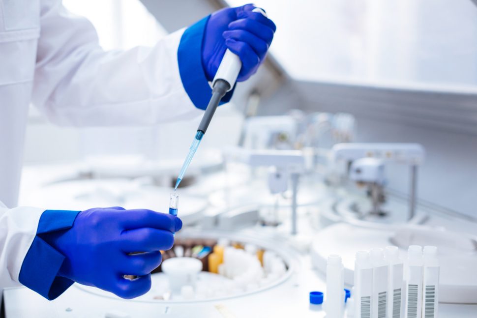 The Best Pipettes for Your Lab | Cryostar Industries, Inc